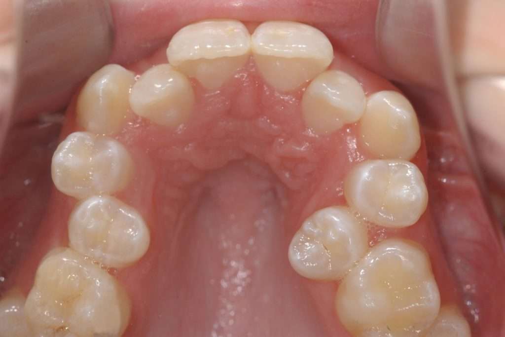 Orthodontic Treatment – Unique Dental Care Rajkot | Orthodontic ...